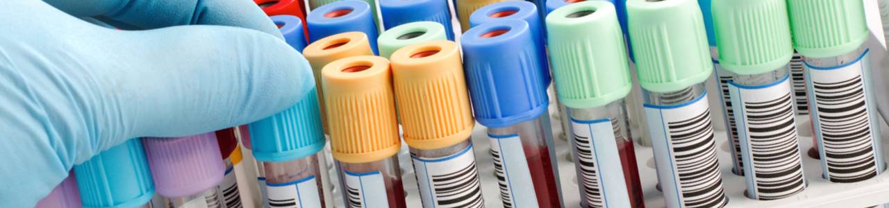 Monotes Tube - PT. Bintang Mono Indonesia